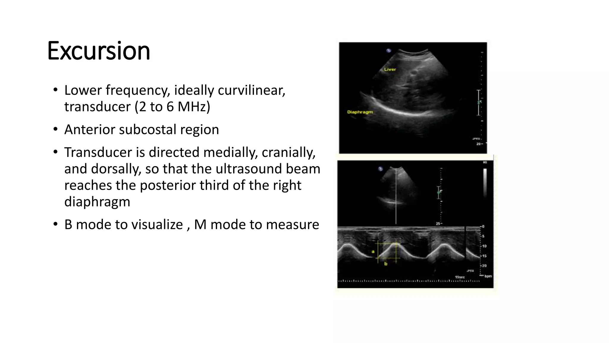 Imaging of diaphragm and its pathologies by Dr. Milan | PPTX