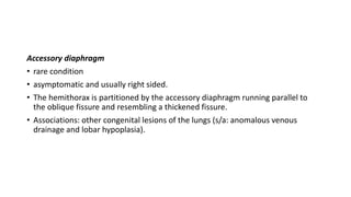 Imaging of diaphragm and its pathologies by Dr. Milan | PPTX