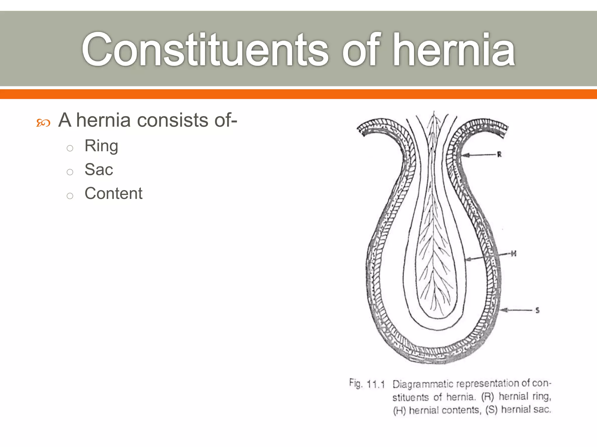 Diaphragmatic hernia | PPTX