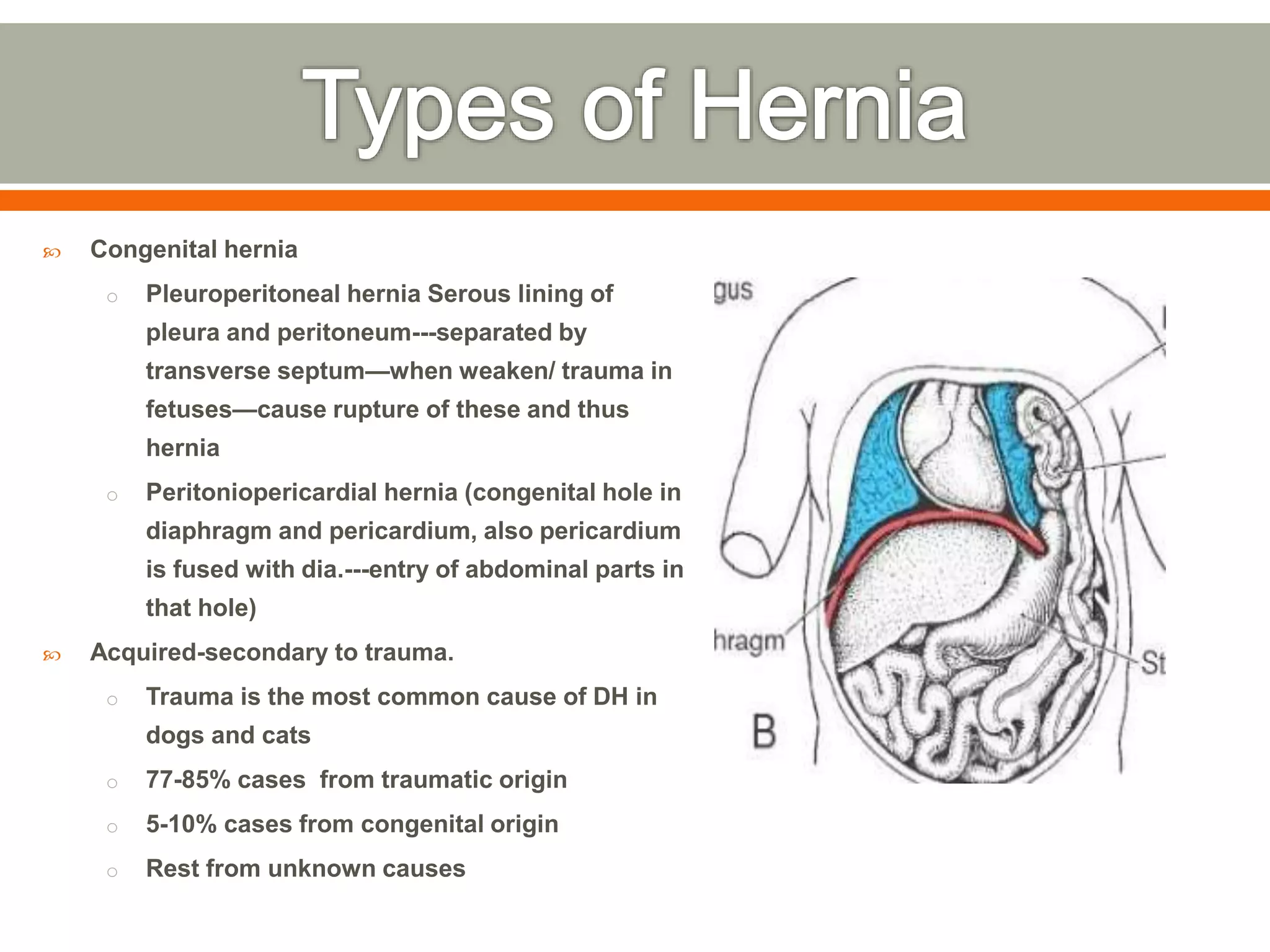 Diaphragmatic hernia | PPTX