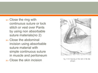 Diaphragmatic hernia | PPTX