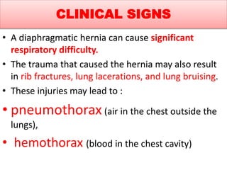 Diaphragmatic hernia.pptx