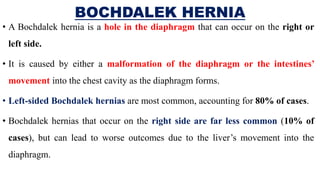 DIAPHRAGMATIC HERNIA .pptx