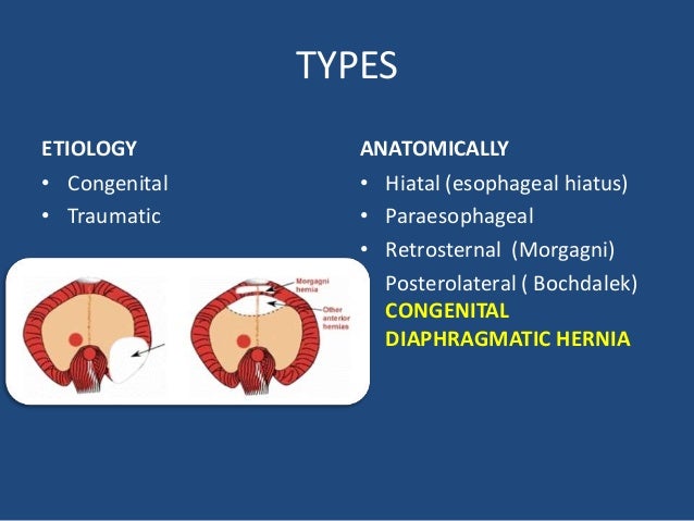 Diaphragmatic hernia
