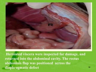 Diaphragmatic hernia in dog.pptx