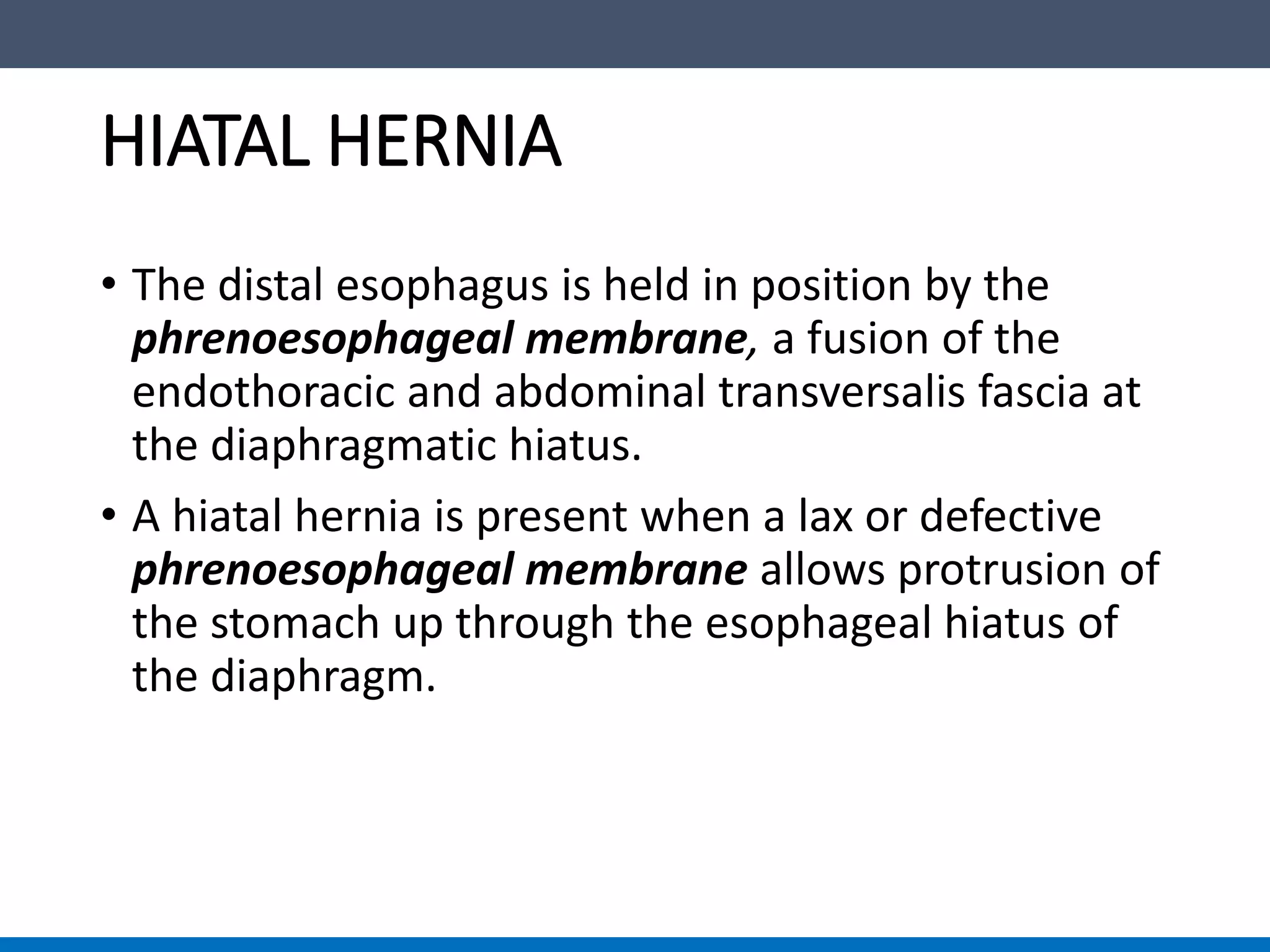 Hiatal hernia, types and management | PPTX