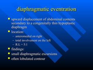 Diaphragmatic rupture & injuries how to repair the lect.ppt