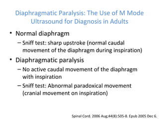Diaphragm Movement And Contractility Evaluation By Thoracic Ultrasound ...