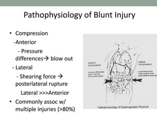 Imaging of Diaphragmatic rupture | PPTX