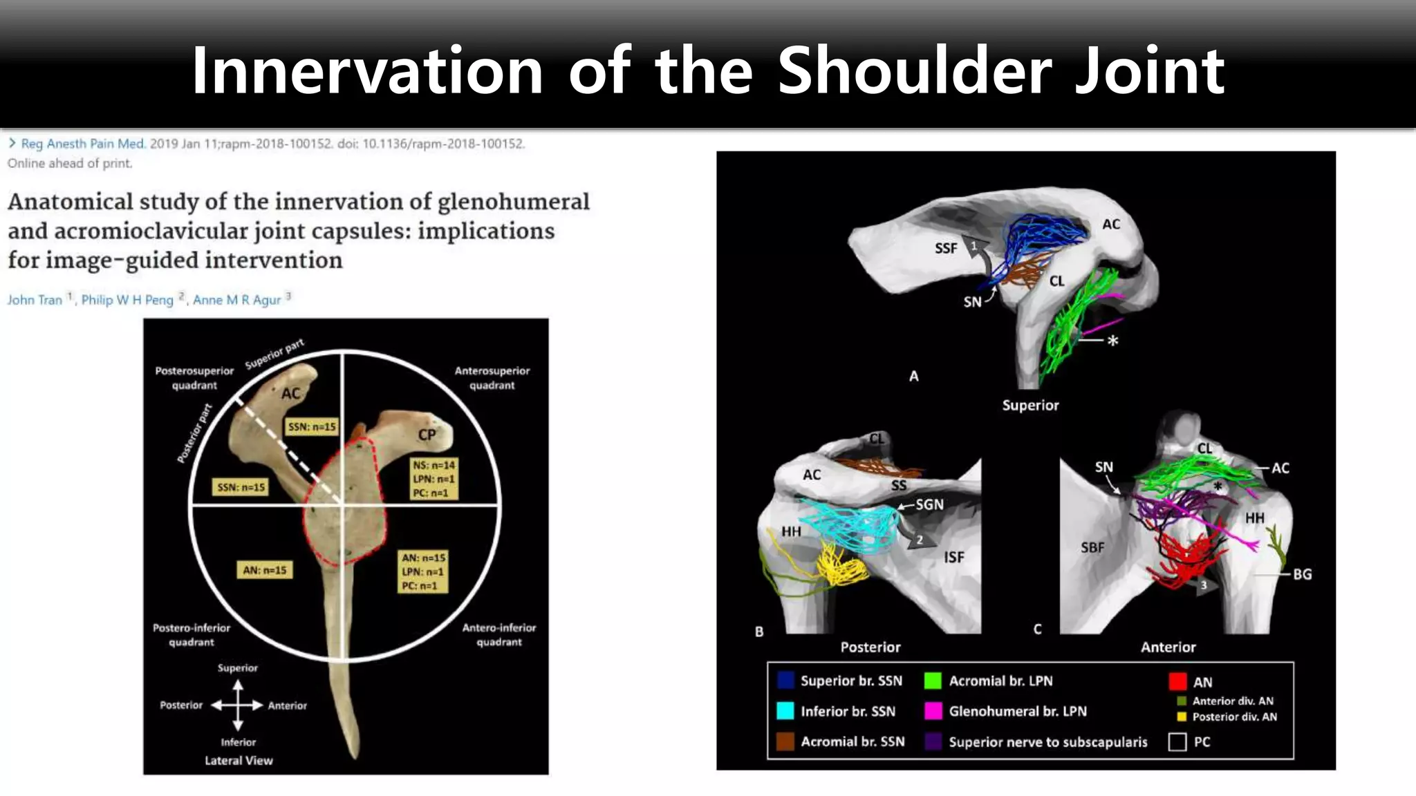 Diaphragm sparing nerve blocks for shoulder surgery | PPTX