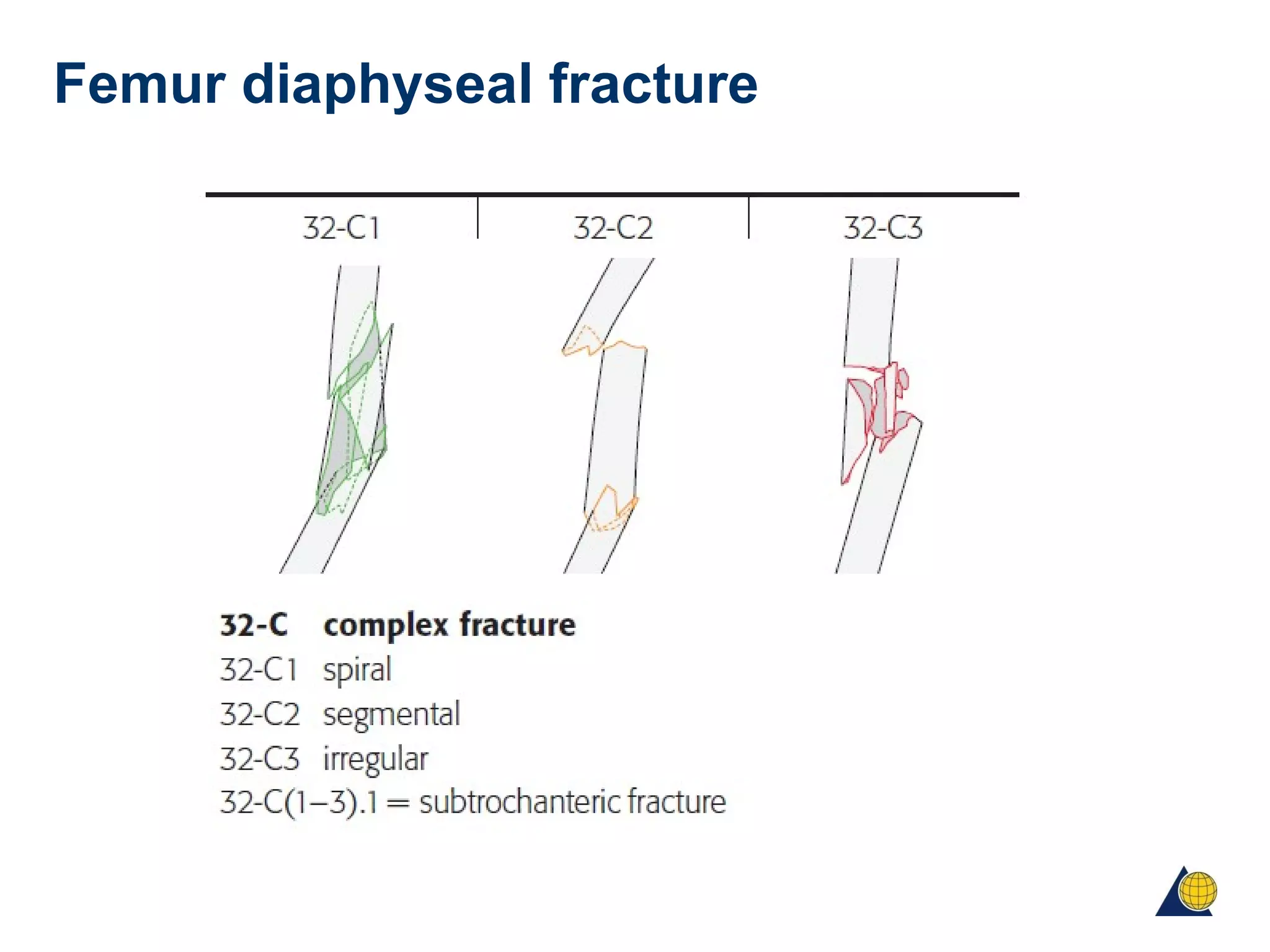Diaphyseal (tibia and femur) fractures | PPT