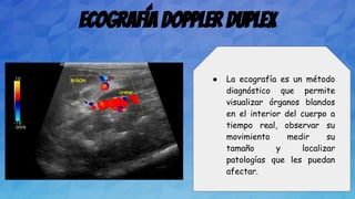 Ecografía Doppler.pptx.pdf