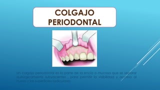 Incisiones y colgajos | PDF