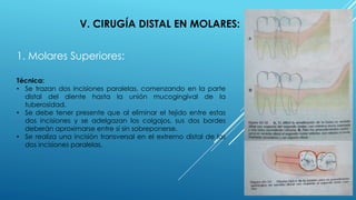 Incisiones y colgajos | PDF