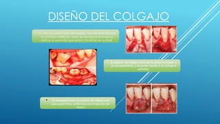 Incisiones y colgajos | PDF