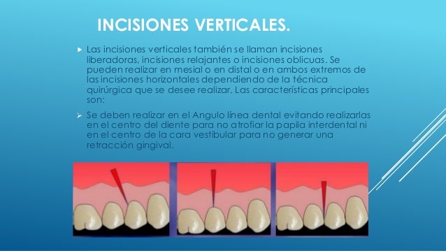 Incisiones y colgajos