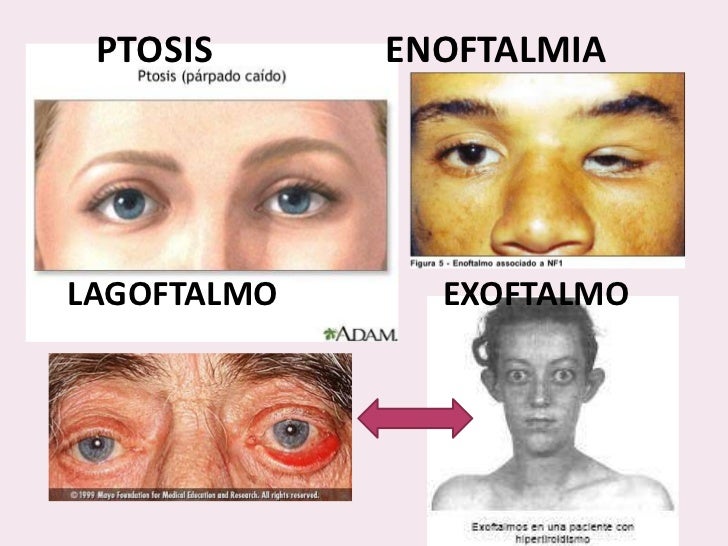 Diapo de semio ya lista!