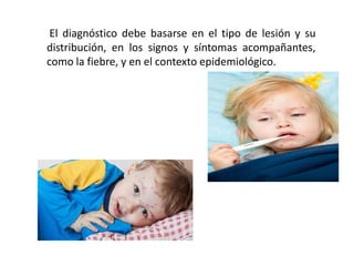 Enfermedades eruptivas infecciosas de la infancia. | PPTX