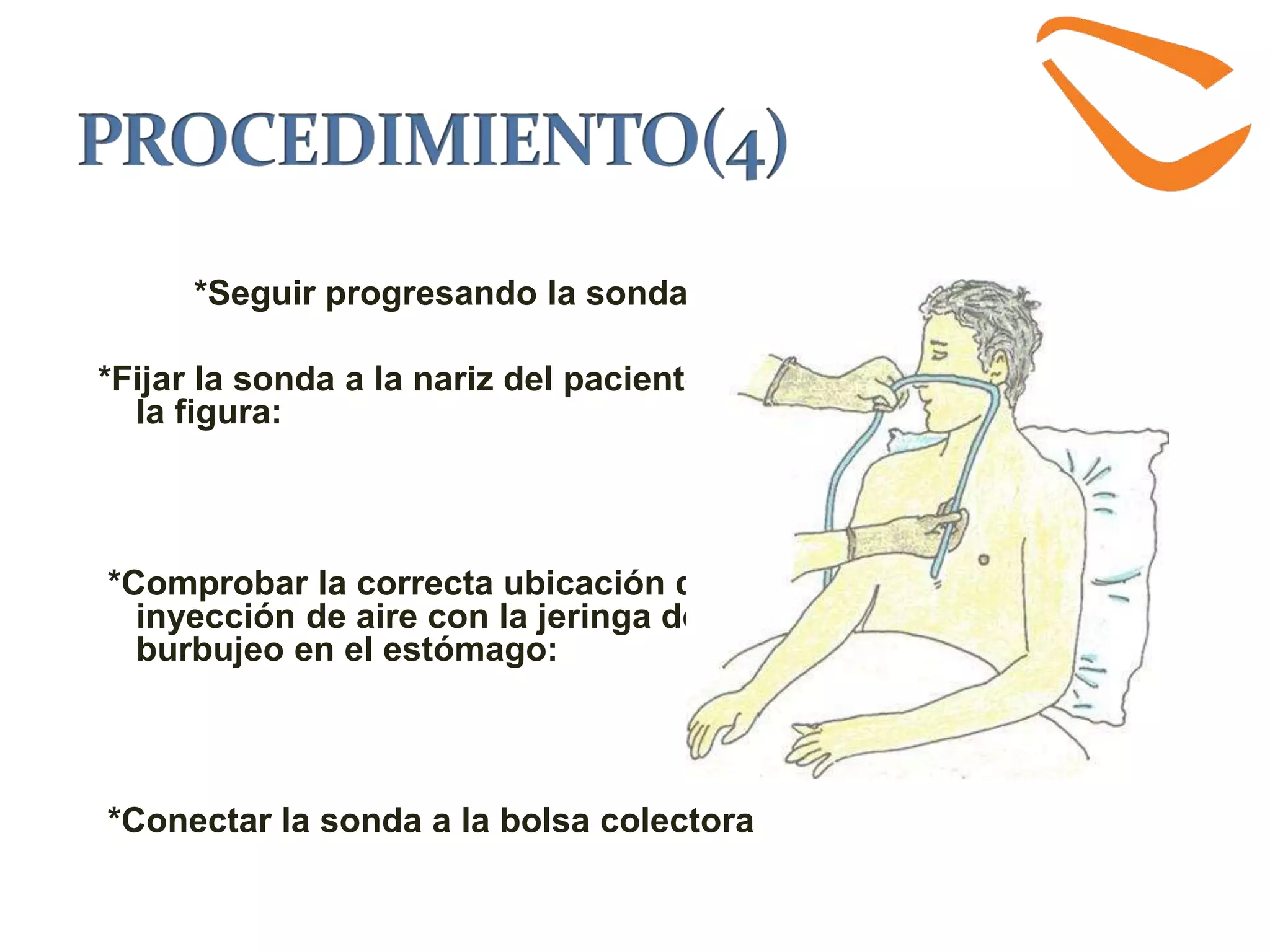 sonda nasogastrica | PPTX