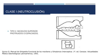 Clasificacion de las Maloclusiones | PPTX