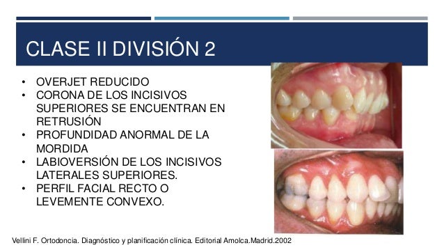 Clasificacion de las Maloclusiones