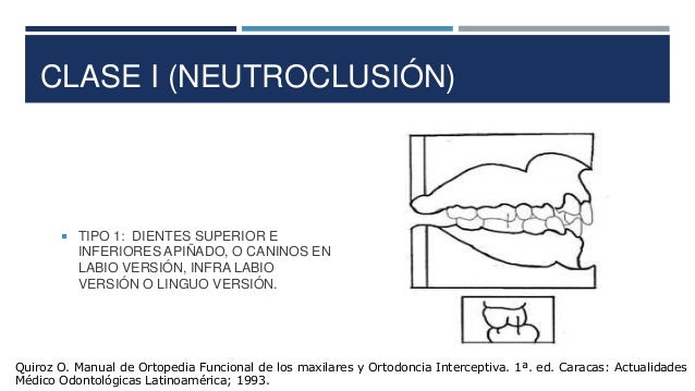 Clasificacion de las Maloclusiones