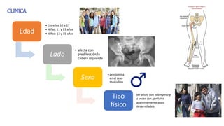 Epifisiolisis femoral | PPTX