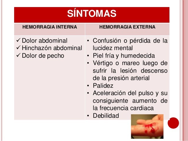 Bombeiroswaldo Hemorragia Classificao Das Hemorragias Externa