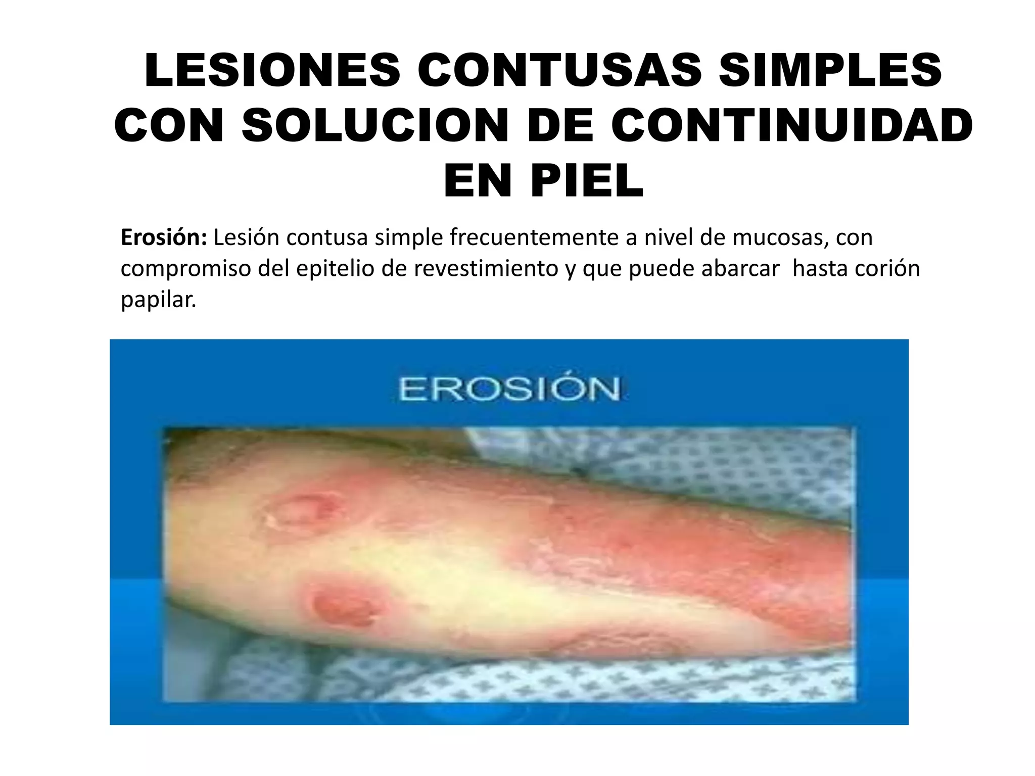 DIAPOSITIVA 4 | PPTX