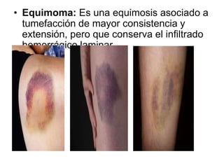 DIAPOSITIVA 4 | PPTX