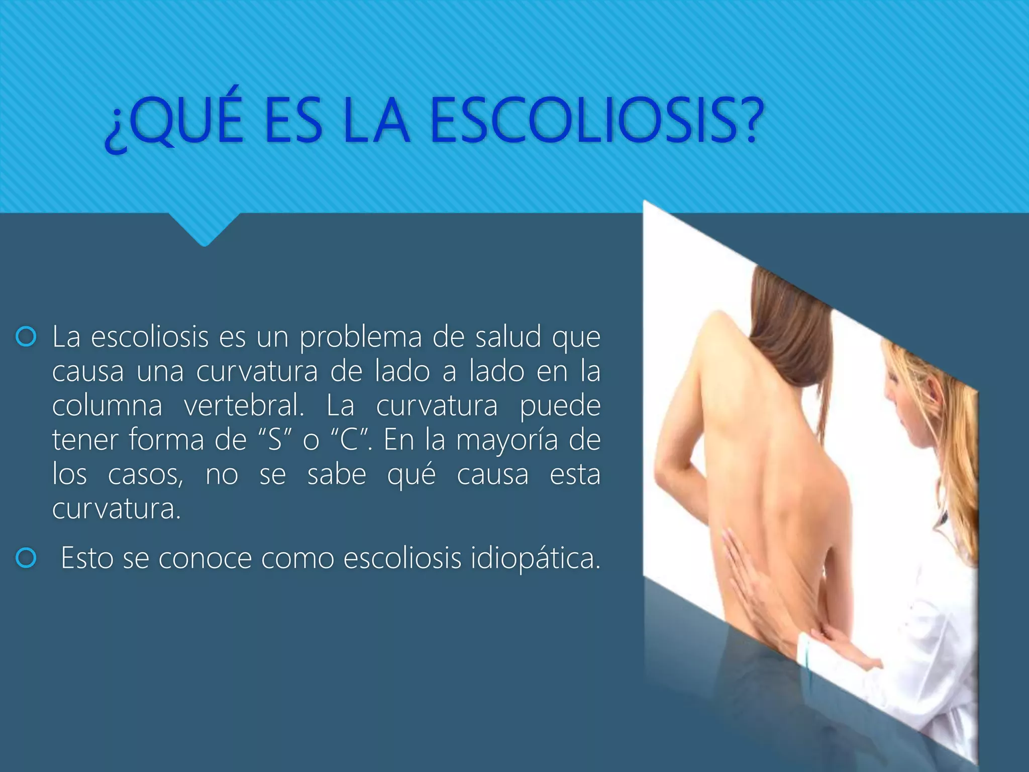 Escoliosis, causas y tratamientos | PPTX