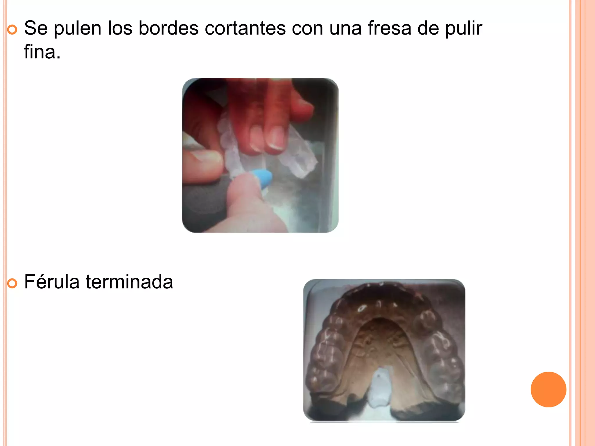 Diapositiva de las férulas oclusales | PPTX | Dental Health | Diseases ...