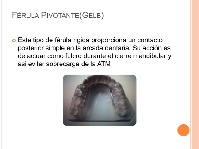 Diapositiva de las férulas oclusales | PPTX | Dental Health | Diseases ...