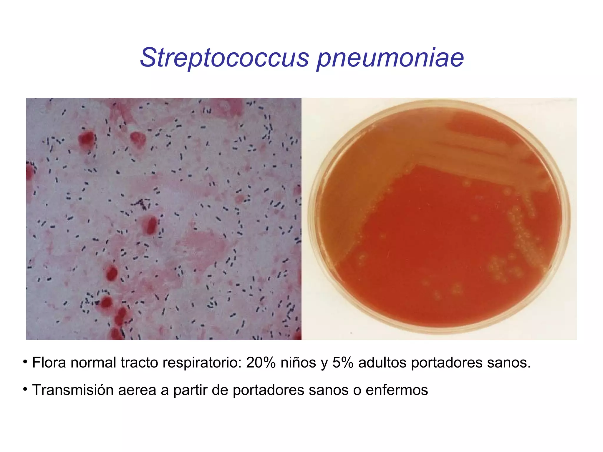 Diapositivas Tema 12.2. GéNero Streptococcus. GéNero Enterococcus | PPT