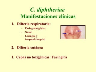 Diapositivas Tema 20. GéNeros Bacillus, Corynebacterium, Listeria. | PPT