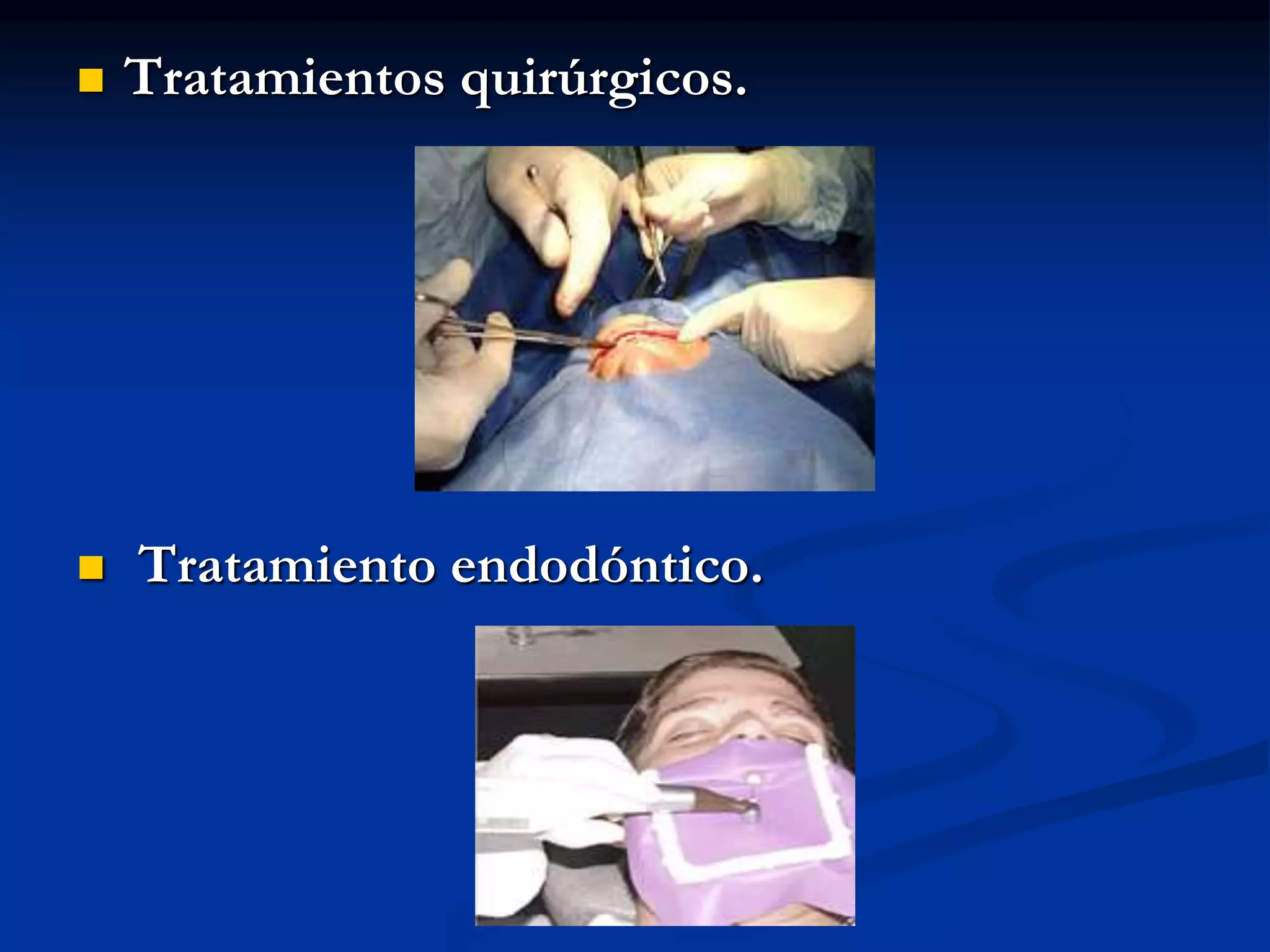 Clase Paraleligrafo o Paralelografo | PPTX