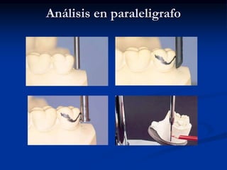 Clase Paraleligrafo o Paralelografo | PPTX