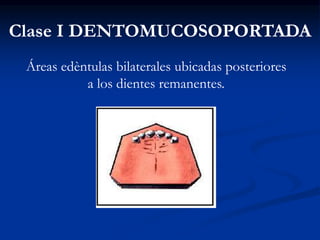 Clase Paraleligrafo o Paralelografo | PPTX