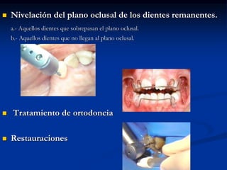 Clase Paraleligrafo o Paralelografo | PPTX