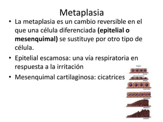 aplasia,metaplasia,displacia,neoplasia | PPTX