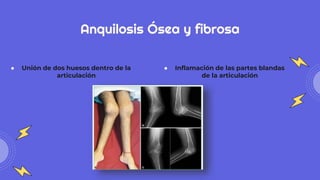 Diapositivas de Oclusión, hipomovilidad. | PPTX