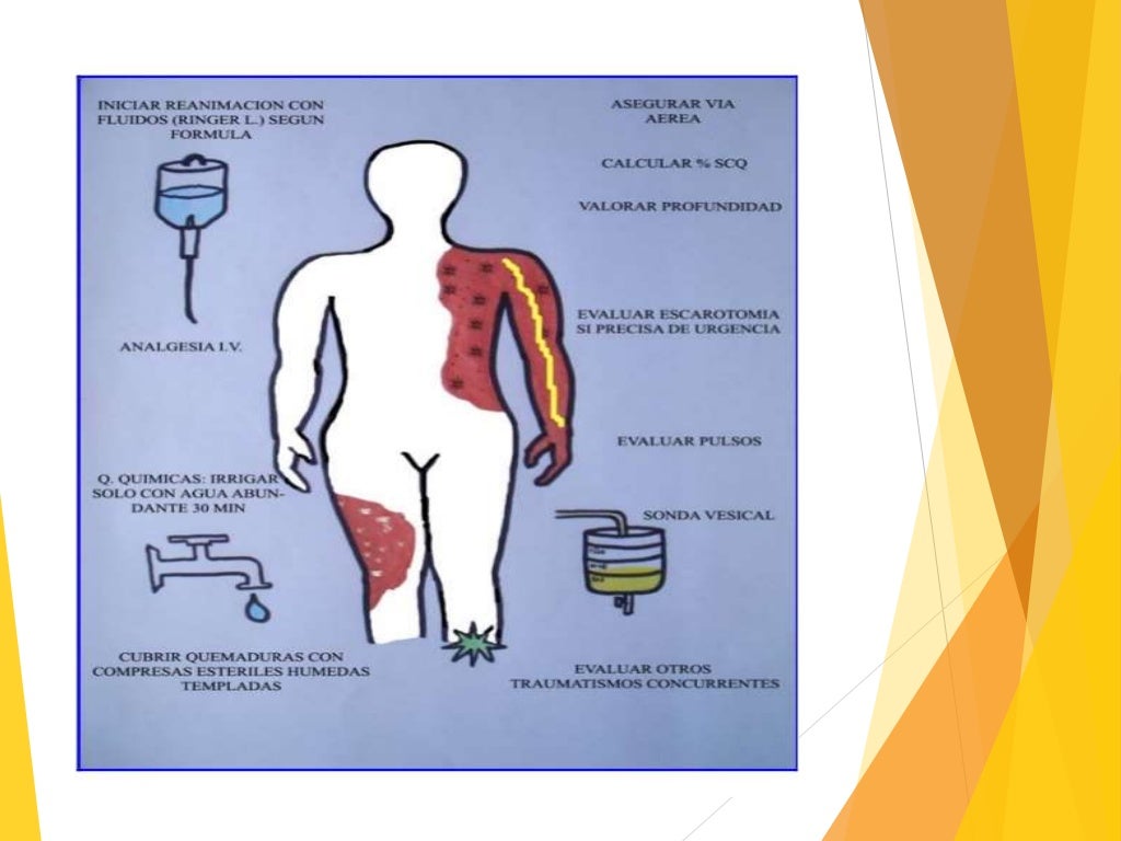 Diapositivas de paciente quemados 2016
