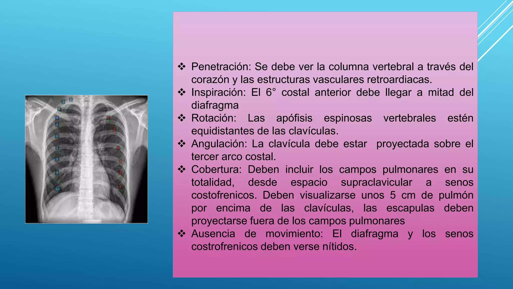 diapositivas de rx de torax.pptx