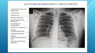 diapositivas de rx de torax.pptx