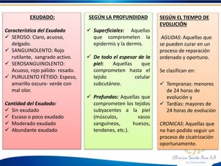 MANEJO DE HERIDAS | PPTX