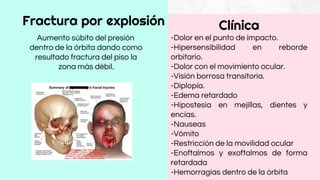 Diapositivas sobre traumatismos oculares | PPTX