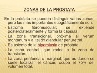 CANCER DE PROSTATA | PPTX