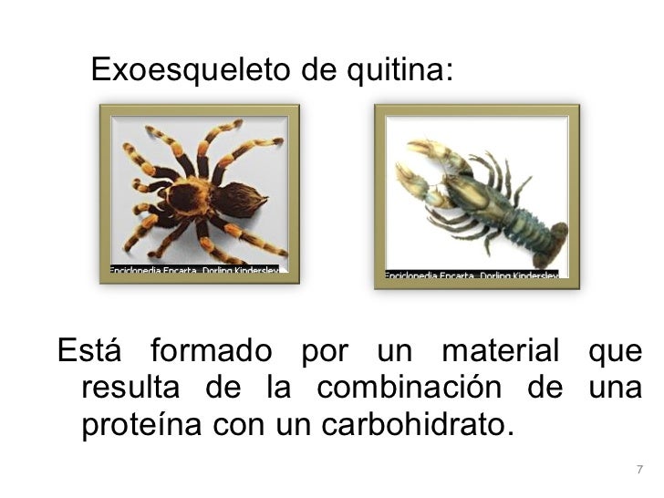 Diapositivas sistema óseo