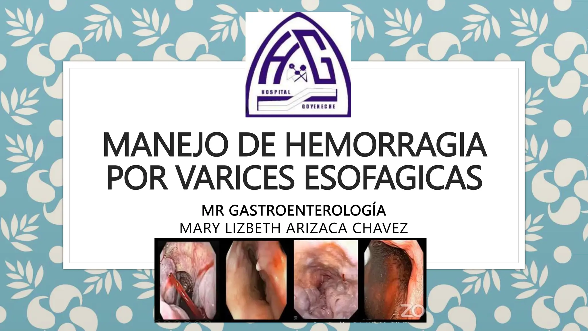 DIAPOS MANEJO DE HEMORRAGIA POR VARICES ESOFAGICAS.pptx