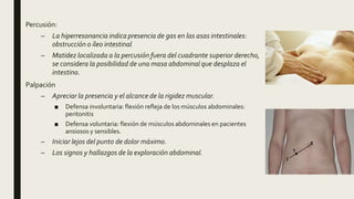diapostivas abdomen agudo nuevo.pptx